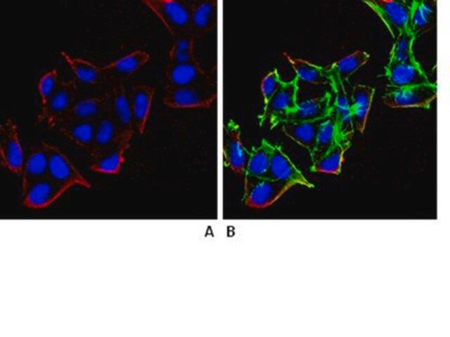 Anti-beta Arrestin 1 Antibody, clone 3H11.2
