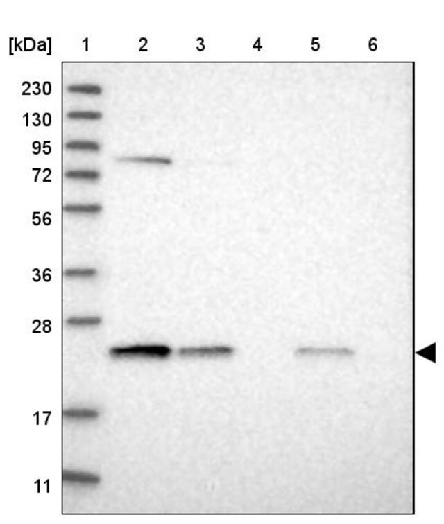 Anti-PSMB6 antibody produced in rabbit