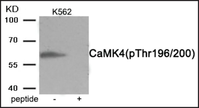 抗-磷酸化-CaMK4 (pThr196/200) 兔抗，Anti-phospho-CaMK4 (pThr196/200) antibody produced in rabbit
