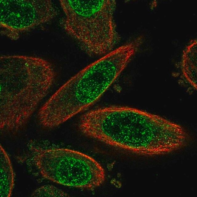 Anti-METRN antibody produced in rabbit
