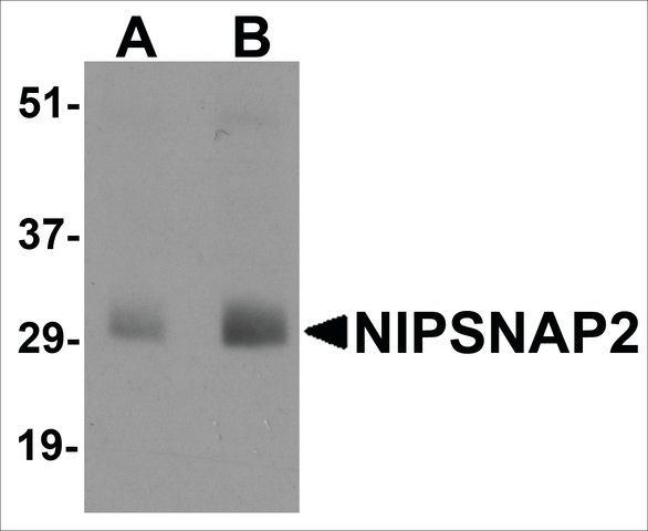 Anti-NIPSNAP2 (ab1) antibody produced in rabbit