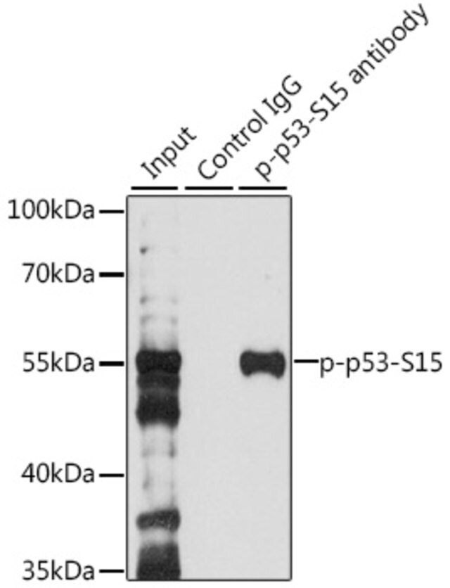Anti-Phospho-p53-S15 antibody produced in rabbit