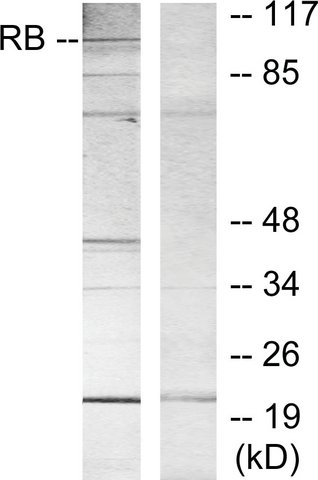 Anti-Retinoblastoma, C-Terminal antibody produced in rabbit