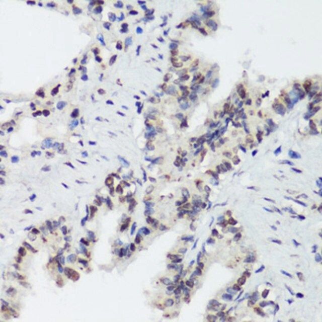 Anti-Phospho-MAPK14-Y182 antibody produced in rabbit