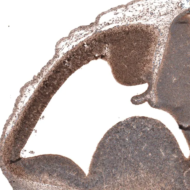 Anti-EMX1 antibody produced in rabbit