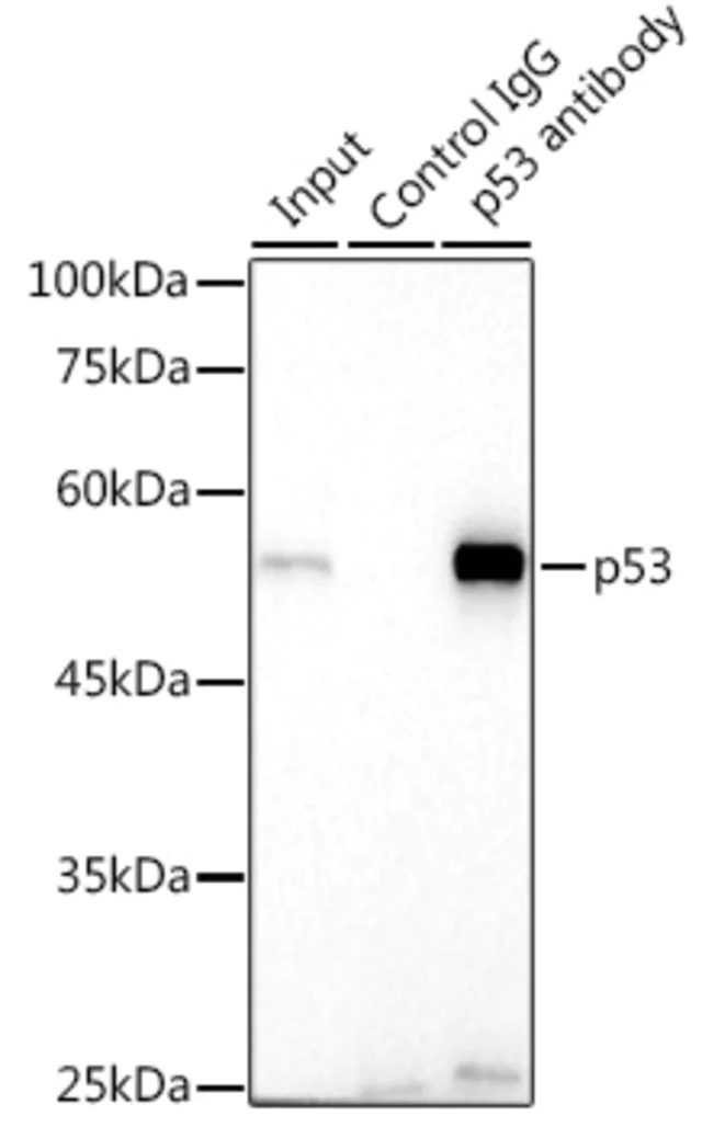 Anti- p53 antibody produced in rabbit