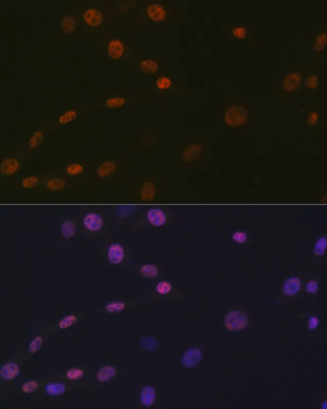 Anti-KAT1/HAT1 antibody produced in rabbit