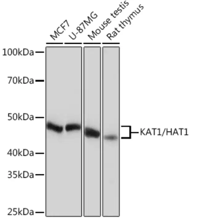 Anti-KAT1/HAT1 antibody produced in rabbit