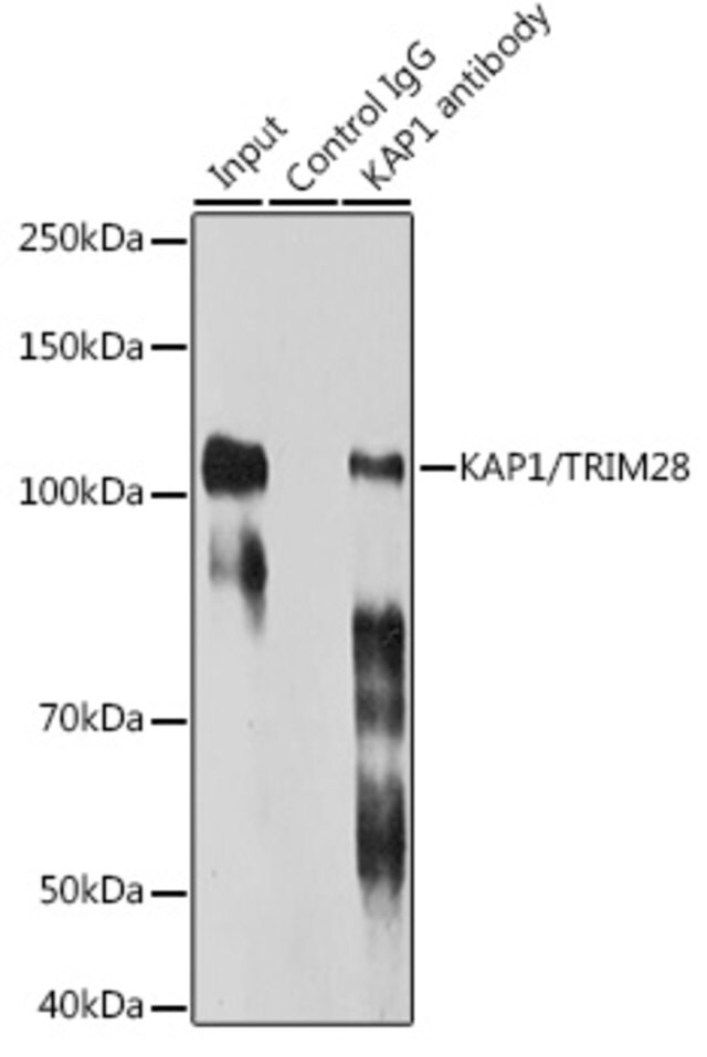 Anti-KAP1/TRIM28 antibody produced in rabbit