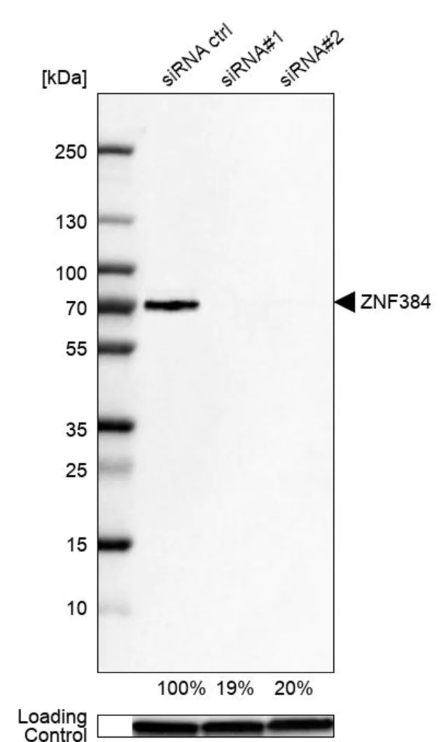 Anti-ZNF384 antibody produced in rabbit