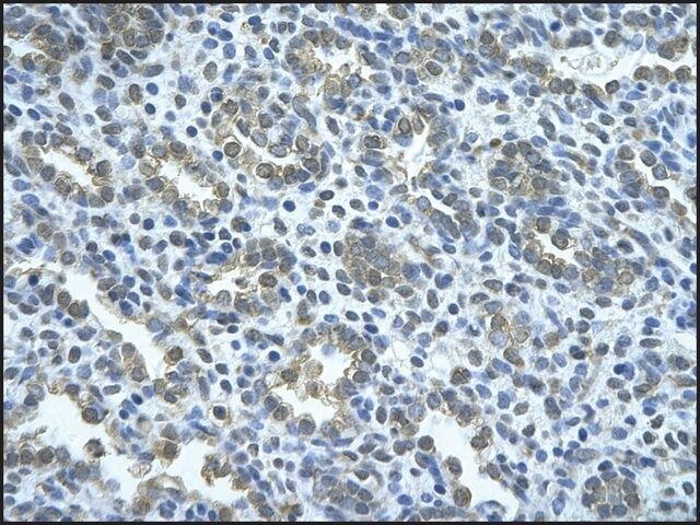 Anti-WWP2 (AB1) antibody produced in rabbit