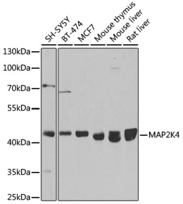 Anti-MAP2K4 antibody produced in rabbit