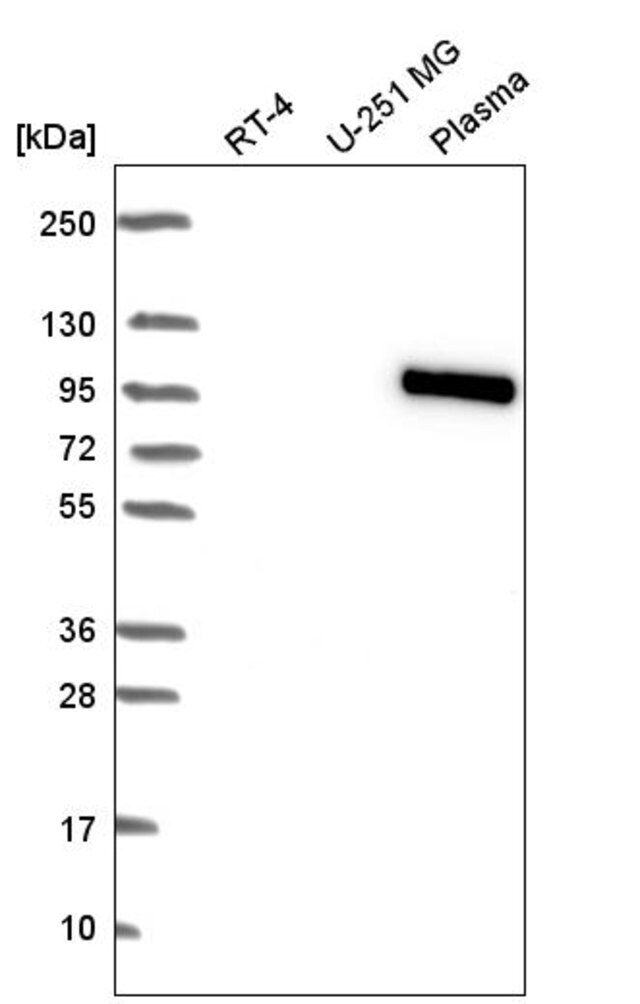 Anti-BNC1 antibody produced in rabbit