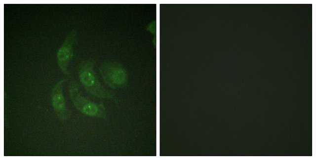 Anti-CAMK4 antibody produced in rabbit