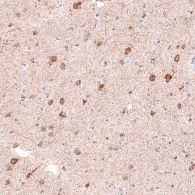 Monoclonal Anti-CDKL5 antibody produced in mouse