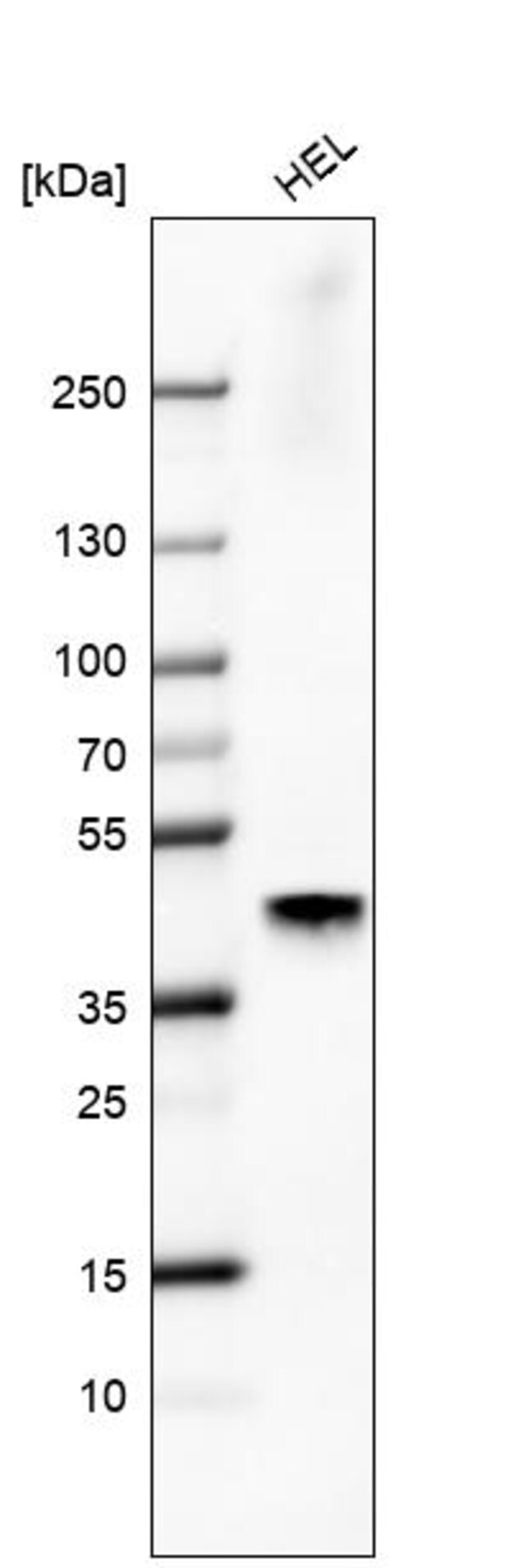 Monoclonal Anti-NR5A1 antibody produced in mouse