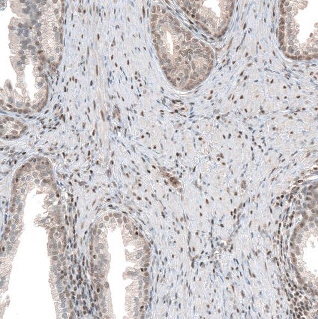 Anti-JADE2 antibody produced in rabbit