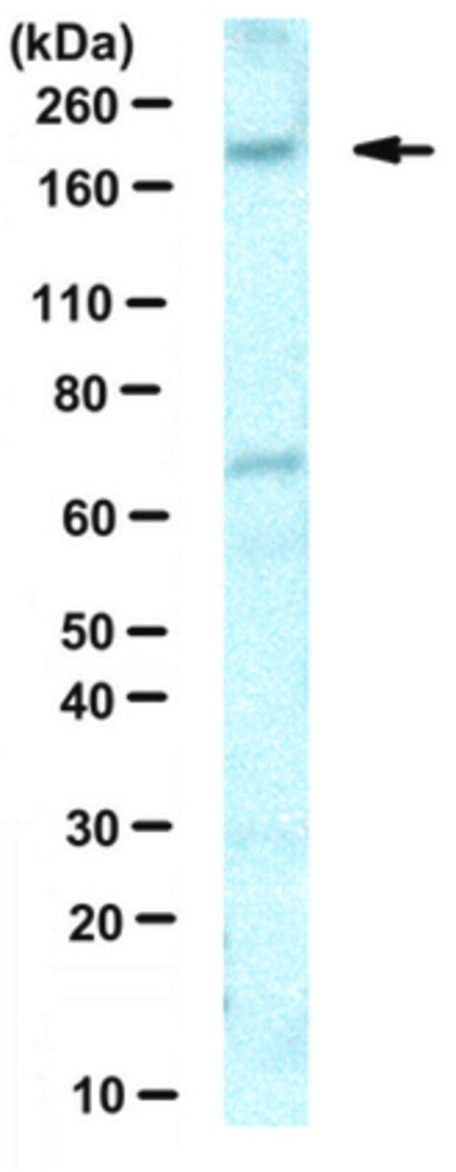 Anti-SUR1 Antibody, clone N289/16