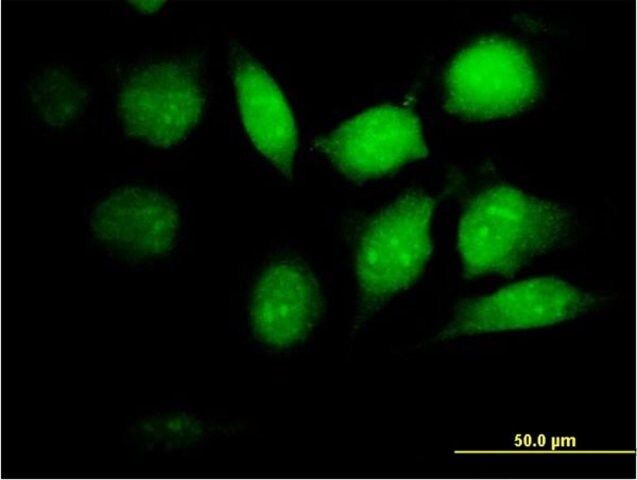 Anti-PSMB8 antibody produced in mouse