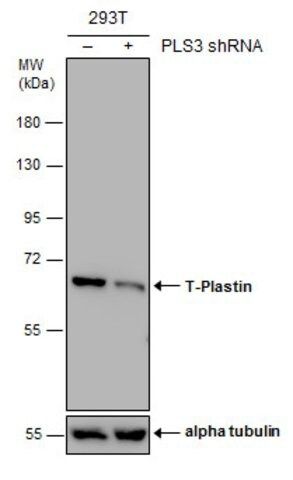 Monoclonal Anti-T-Plastin antibody produced in mouse