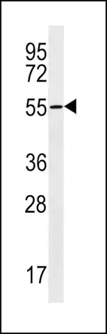 ANTI-RNF150(N-TERMINAL) antibody produced in rabbit