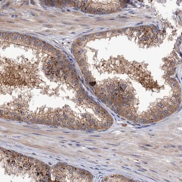 Anti-PATL1 antibody produced in rabbit