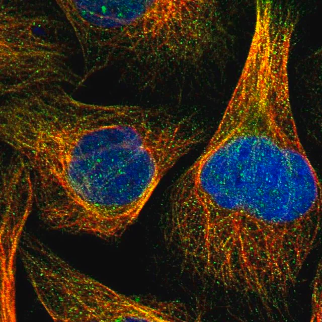Anti-RNF141 antibody produced in rabbit