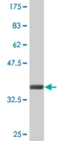 Monoclonal Anti-CLCN7, (C-terminal) antibody produced in mouse