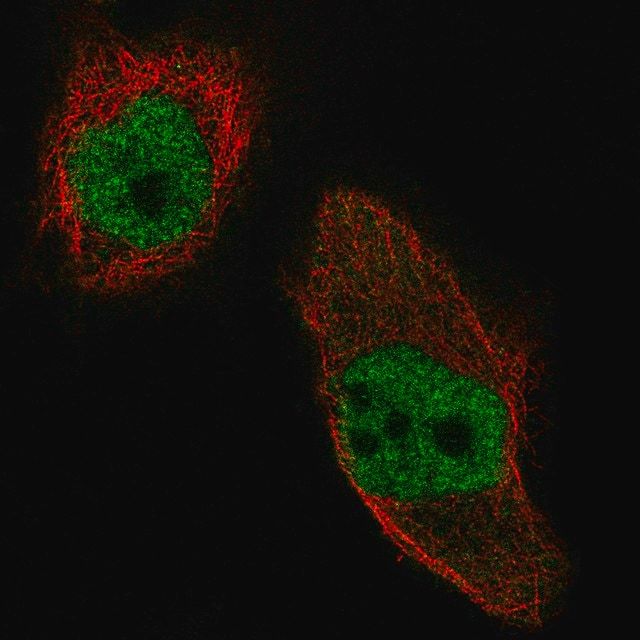 Monoclonal Anti-NSD2 antibody produced in mouse
