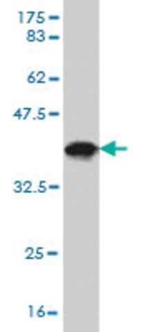 单克隆抗 SALL4 小鼠抗，Monoclonal Anti-SALL4 antibody produced in mouse