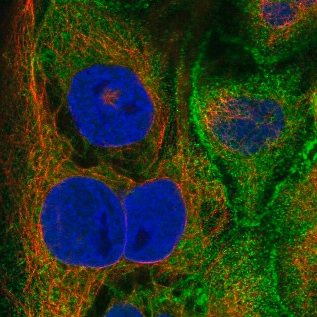 Anti-VIL1 antibody produced in rabbit