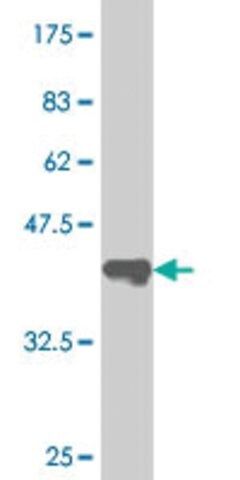 Monoclonal Anti-SUPT16H antibody produced in mouse